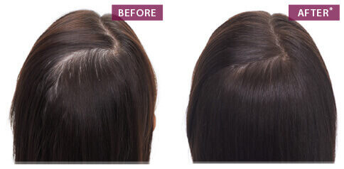 Keranique Hair Regrowth | Hair Growth Products For Women